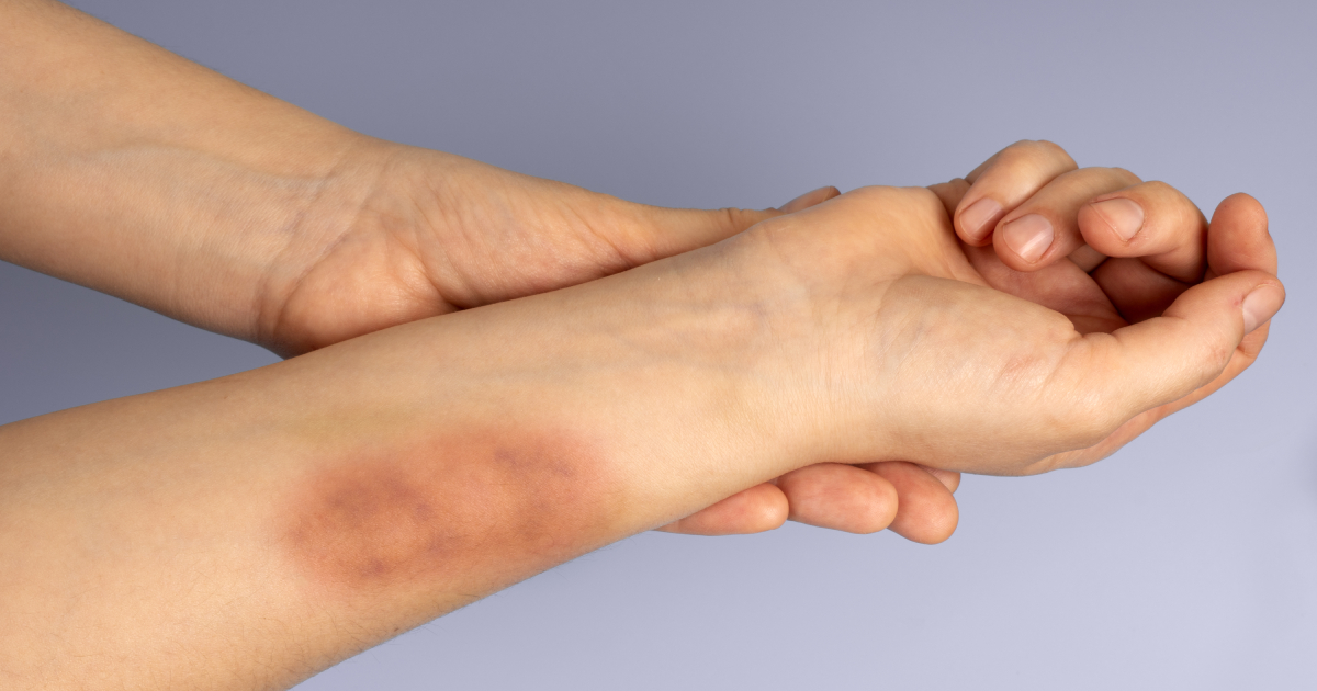 5 Tips on How to Increase Your Chances of Winning Your Personal Injury ...